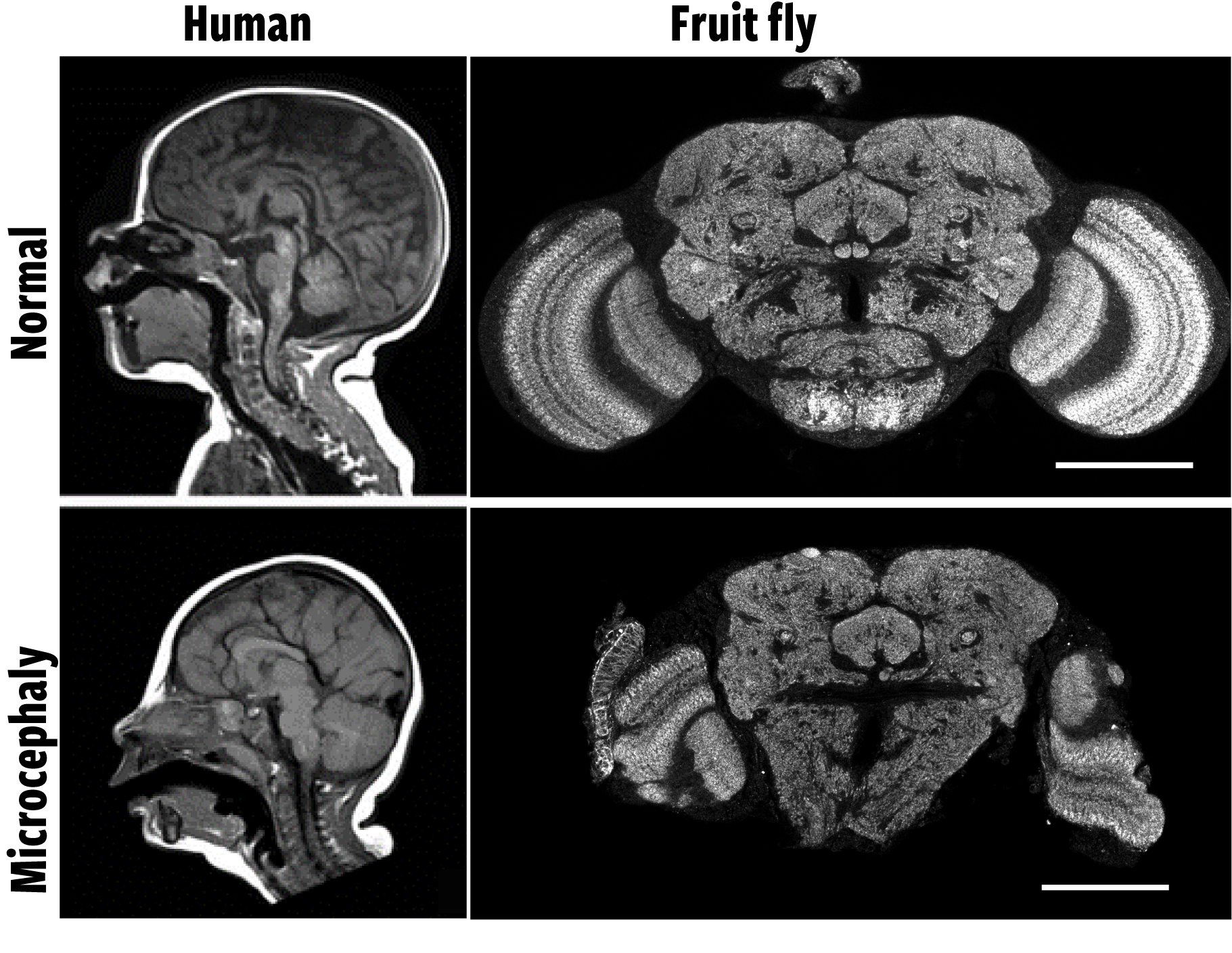 What the fruit fly can tell us about human disease – AgNews